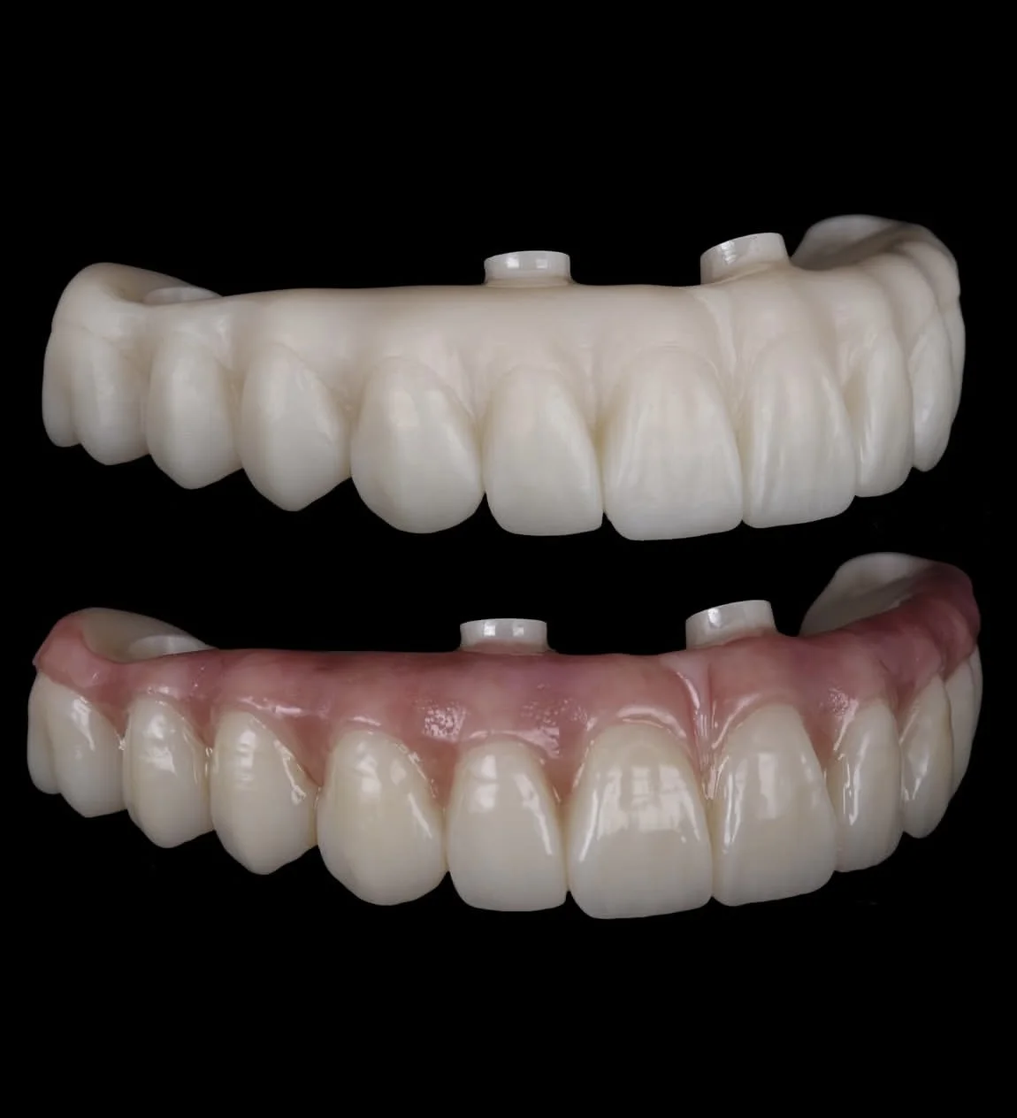 Products - Peak Dental Lab - Dental Implant & Full Arch Lab Fabrication